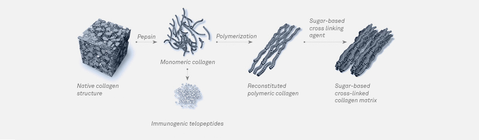 Ossix® Plus - Reasorbable Collagen Dental Membrane - Implantology And ...